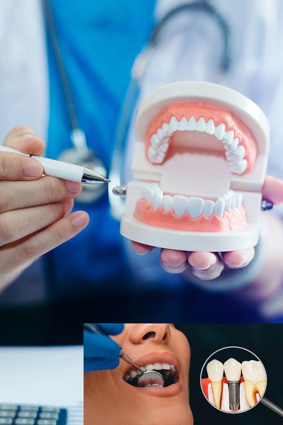 Single tooth implant will restore your smile in the Smile Anatomy Center